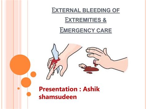 Bleeding And First Aid For Bleedingpptx