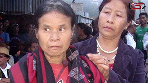 دختری که 38 سال توسط حیوانات وحشی جنگل بزرگ شده این ریخت و قیافه ای