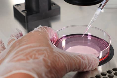 Egg Retrieval Process In Ivf Step By Step Guide