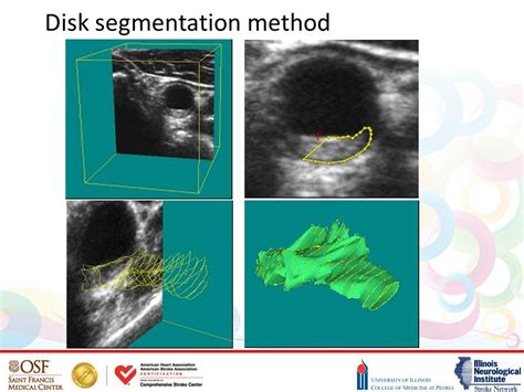 Treating Arteries Instead Of Treating Risk Factors Ppt Download