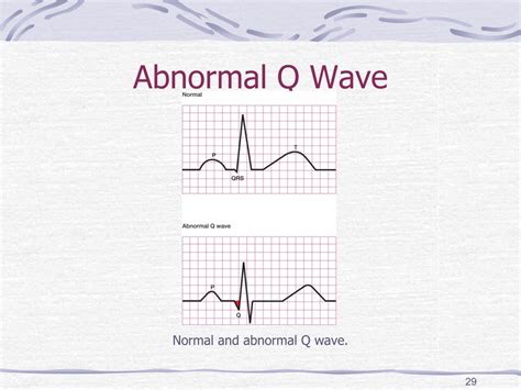 Abnormal Q Wave
