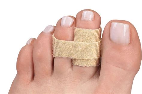Toe Fracture Treatment Protective Footwear Orthotics Plus Melbourne
