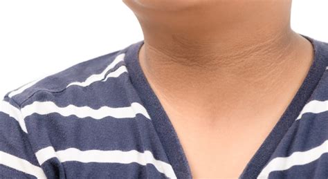 孩子脖子发黑，怎么洗也洗不掉？不是晒的，这种原因你可能没想到 知乎