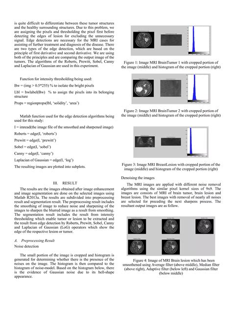 empirical edge detection and extraction of lesion using image
