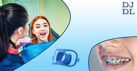 The Ins And Outs Of Bite Blocks In Orthodontics Blog