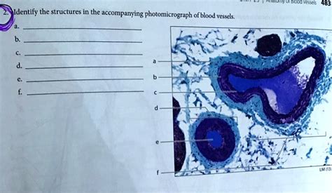 SOLVED Identify The Structures In The Accompanying Photomicrograph Of