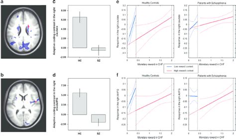Reward Sensitive Regions Showing Group Differences In Adaptive Coding
