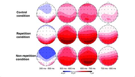 Scalp Topographic Distributions Of Different Conditions In Different Download Scientific