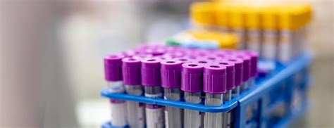 Serology Test List Sars Cov 2 Antibody Testing Quest Diagnostics