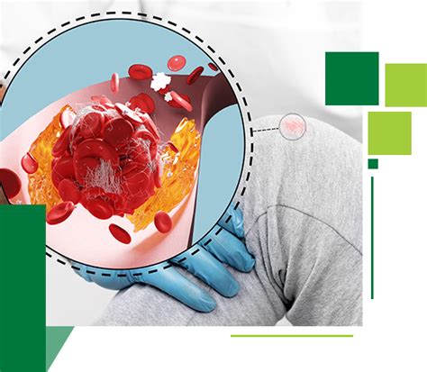 Ayurvedic Platelet Dysfuntion Medicine Herbal Range