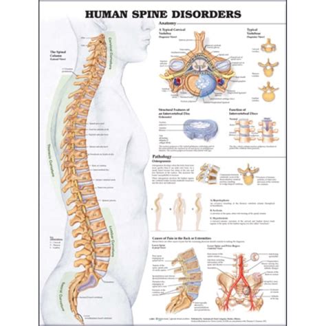 Human Spine Disorders Anatomical Chart Soft Laminate Australian