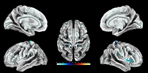 Brain Region Linked To Genital Touch In Women Is Discovered Daily Mail Online