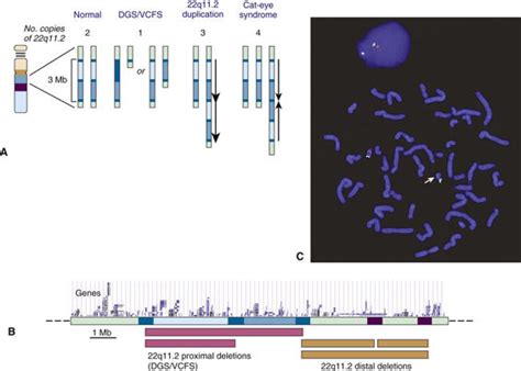 Disorders Microdeletion And Duplication Syndromes Basicmedical Key
