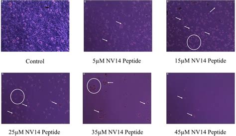 Effect Of Nv14 Peptide In Cellular Morphology In Mcf 7 The Cells Were
