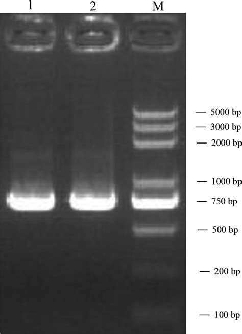 Pcr Amplification Using Its1 And Its4 Primers Of Colonized Roots And