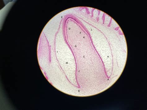 Early Dentin Diagram Quizlet