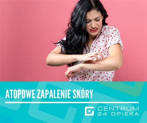 Atopowe zapalenie skóry objawy leczenie Centrum 24 Opieka