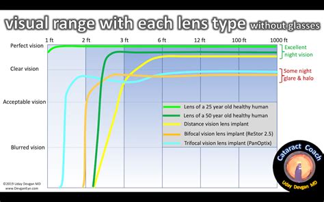 The Alcon Panoptix Trifocal Lens Implant Devgan Eye Surgery