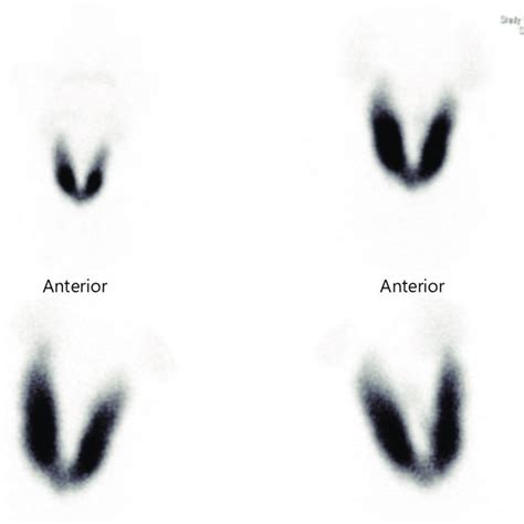 Enlarged And Homogeneous Thyroid Download Scientific Diagram