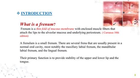 Frenal Attachment And Its Management Ppt