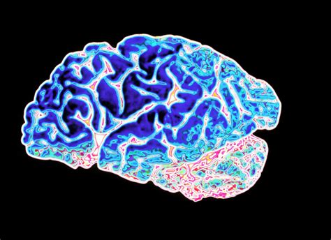 One Thing Alzheimers Sufferers Dont Forget About Is Sex