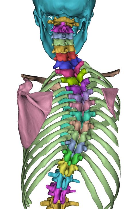 脊柱侧弯全套骨骼3D打印模型 脊柱侧弯全套骨骼3D打印模型stl下载 生物医学3D打印模型 Enjoying3D打印模型网