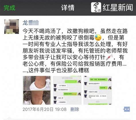 女子被狗咬按时打针仍死亡 丈夫质问：为何疫苗没用凤凰资讯