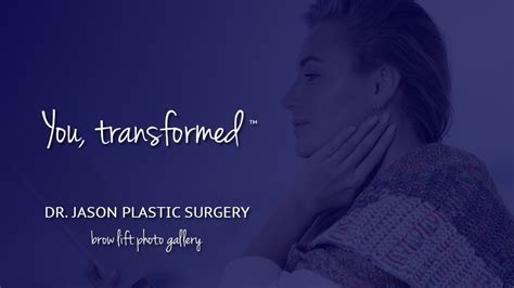 Female Brow Lift Photos Natural Looking Plastic Surgery Dr Jason Plastic Surgery