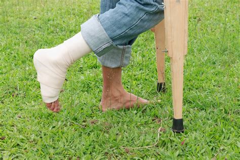 Patah Tulang Kaki Gejala Penyebab Pengobatan Dll