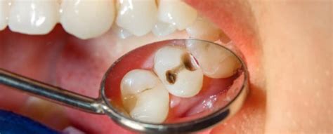 Youre Probably Brushing Your Teeth Wrong Here Are 4 Tips For Better