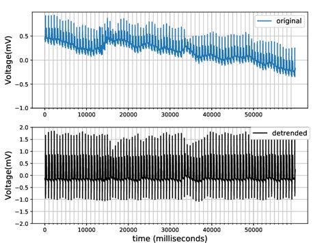 Time Series Of A Typical Ecg Data Set Before Detrending Top And