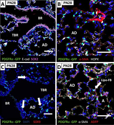 Spatial Localization Of Pdgfrα Gfp Fibroblasts To The Bronchiolar Tree