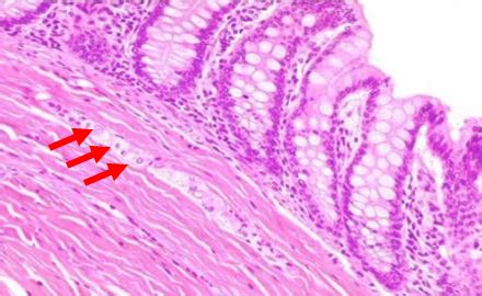 GI Micro Flashcards Quizlet
