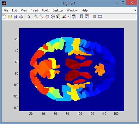 Template Anatomical Atlases And Parcellation Schemes Fieldtrip Toolbox