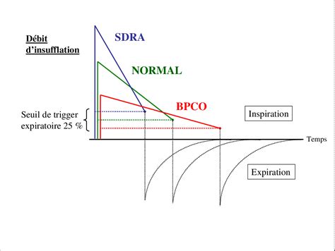 Figure 1 From Asynchronies Patient Ventilateur Au Cours De La Ventilation Assistée Semantic