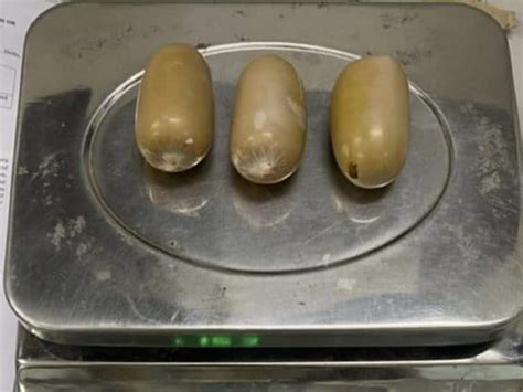 Man Smuggles Gold Worth Rs 52 Lakh From Dubai Inside Rectum Arrested