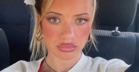 Woman Who Scarred Face By Tattooing Freckles Suffers Another Beauty