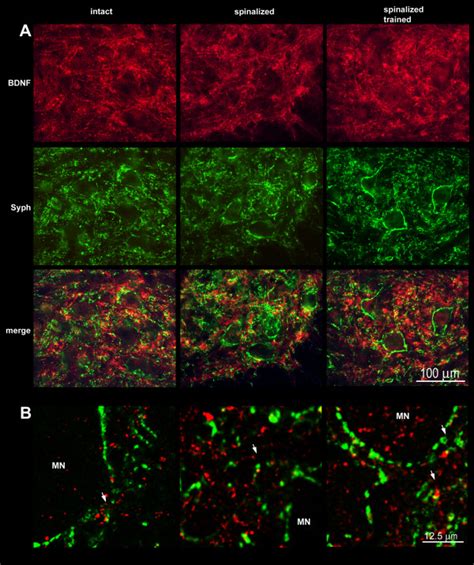 Co Localization Of Bdnf Red And Synaptophysin Green Download