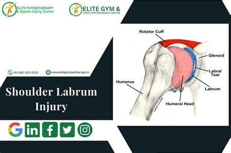 Shoulder Labrum Injury Physiotherapy Management At Elite