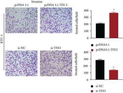 Tfe3 Accelerates Ptc Cell Migration And Invasion In Vitro A B Wound