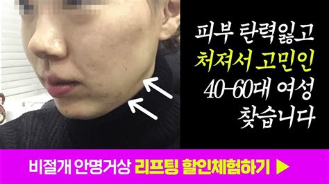 비절개안면거상리프팅 Youtube