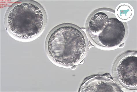 Ivf Embryos In Our Lab Embrio Ltd