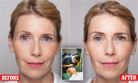 How To Fix Uneven Eyebrows Without Makeup