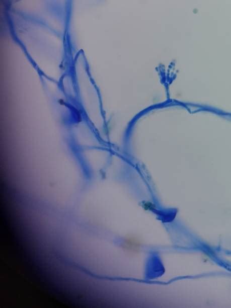 40 Penicillium Notatum Foto Stok Potret And Gambar Bebas Royalti Istock