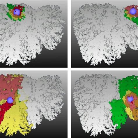 Biphasic Ct Scan As An Example For Current Imaging Examinations For