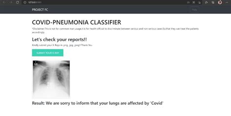 GitHub Ayshwarya Covid And Pneumonia Detection