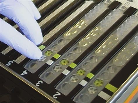 Max Enteric Viral Panel Nr Bd