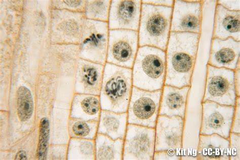 Onion Root Tip Kit Ng Ph D