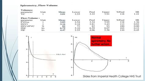 Spirometry Interpretation And Copd Treatments Ppt Download