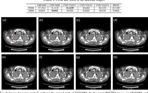 Figure 2 From Ct Image Denoising With Perceptive Deep Neural Networks